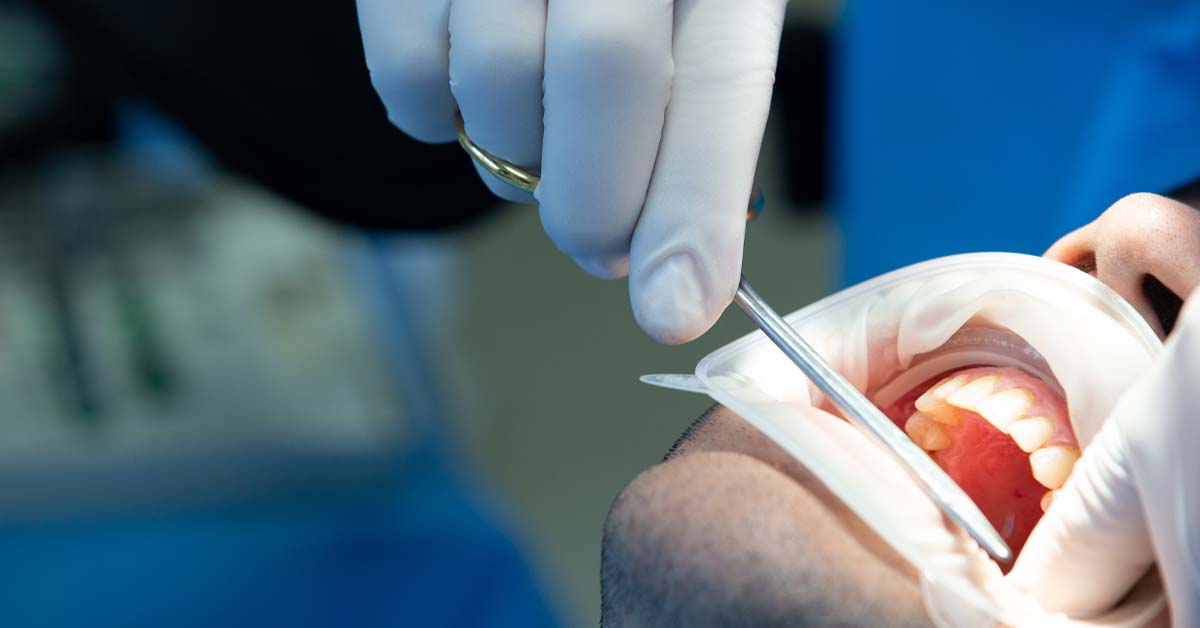 Maxillofacial Surgery - Everything You Need To Know!