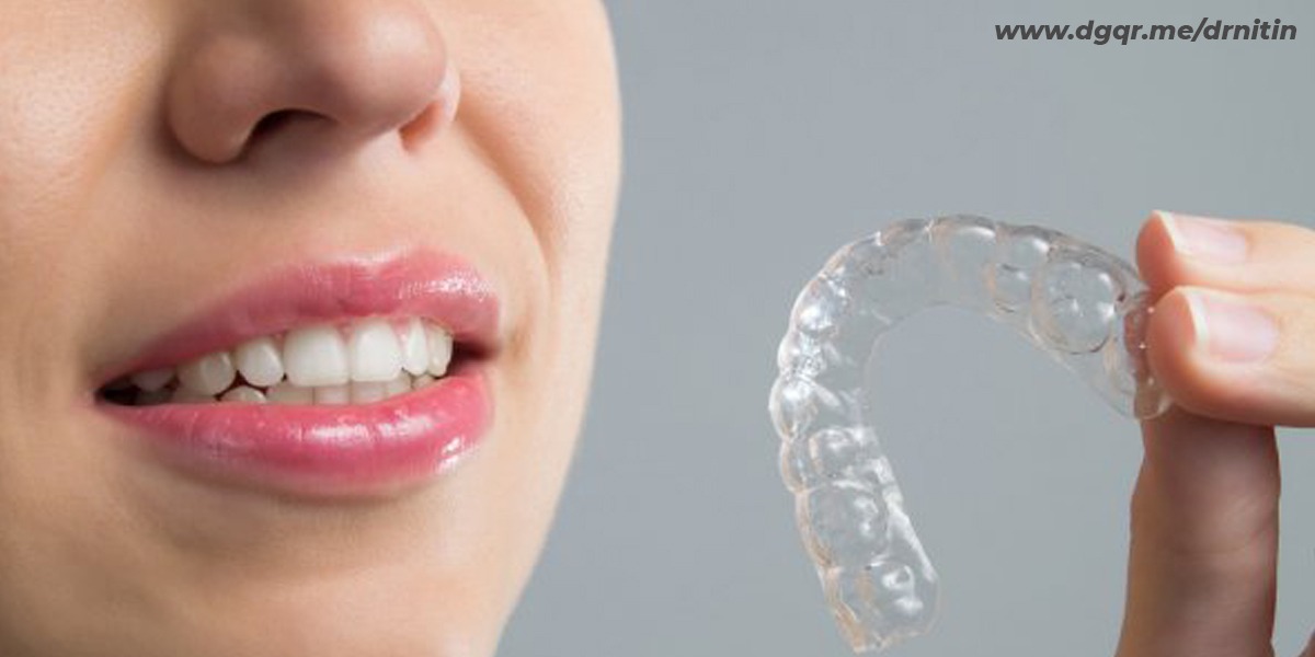 Invisalign Treatment: Its Impact on Teeth & What to Expect